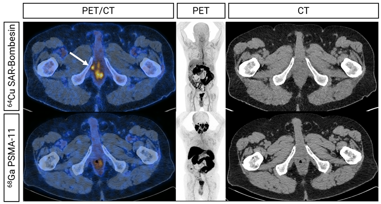BOP Preliminary Trial Results Presented at EANM 2023 Conference
