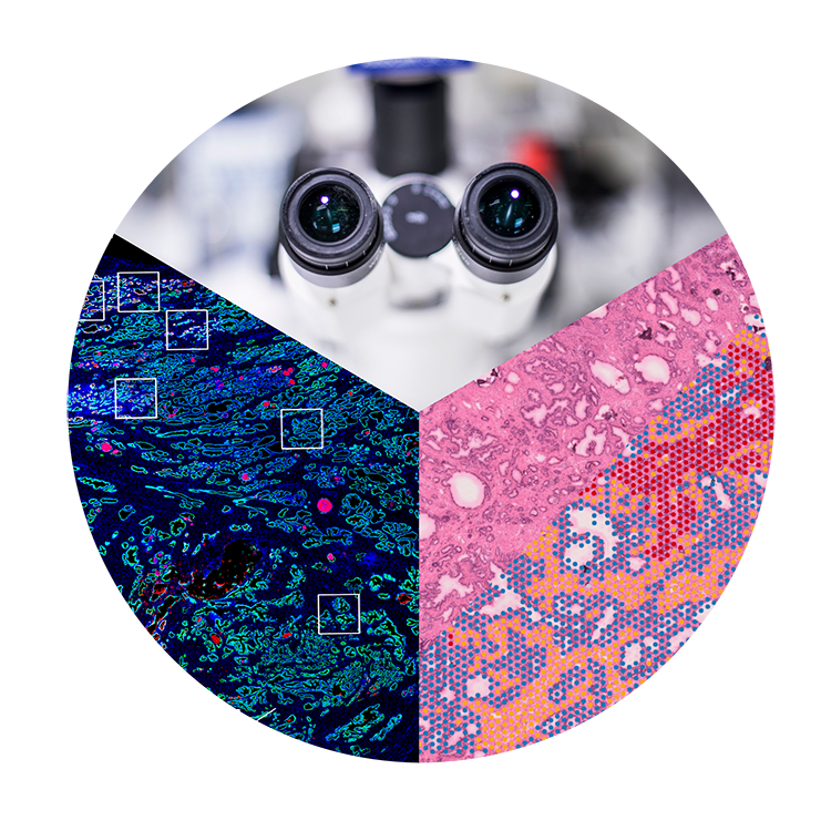 Single Cell and Spatial Transcriptomics Highlight the Interaction of ...