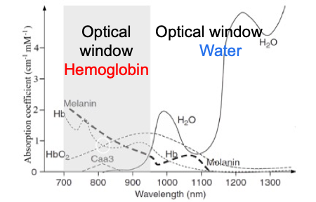 AUA 2025: A Wearable Optical System for Monitoring Neurogenic Bladder ...
