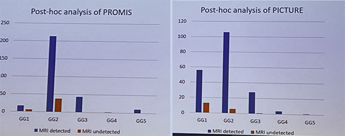 AUA 2023: PSA Screening: Proactive or Counterproductive?