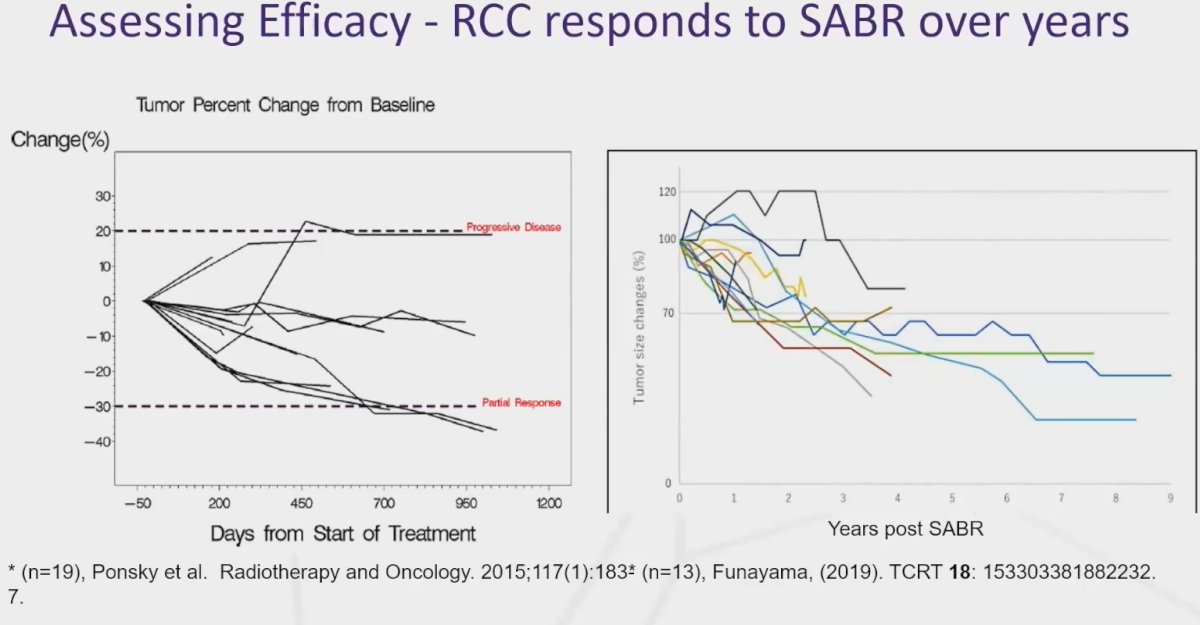 ASTRO 2023: Technical Considerations, Response Assessment and ...
