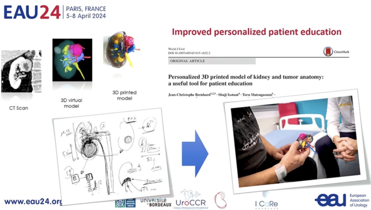 EAU 2024: Controversies in Initial Staging for Renal Cell Cancer ...