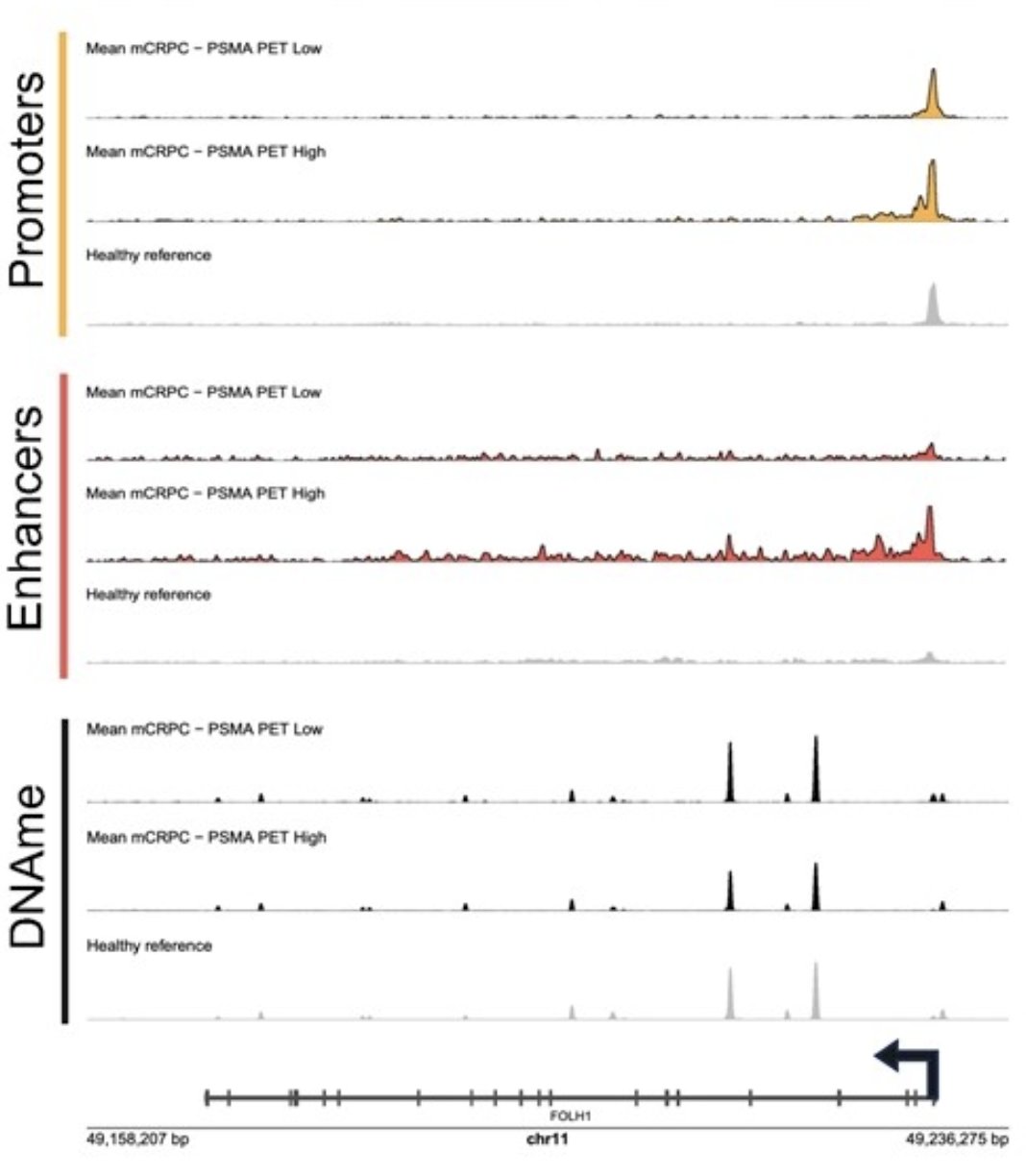 ESMO 2024: Determination of Tumor PSMA Expression in Prostate Cancer ...