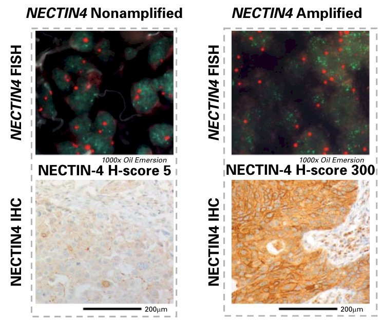 IBCN 2024: Mechanisms of Resistance to Antibody Drug Conjugates