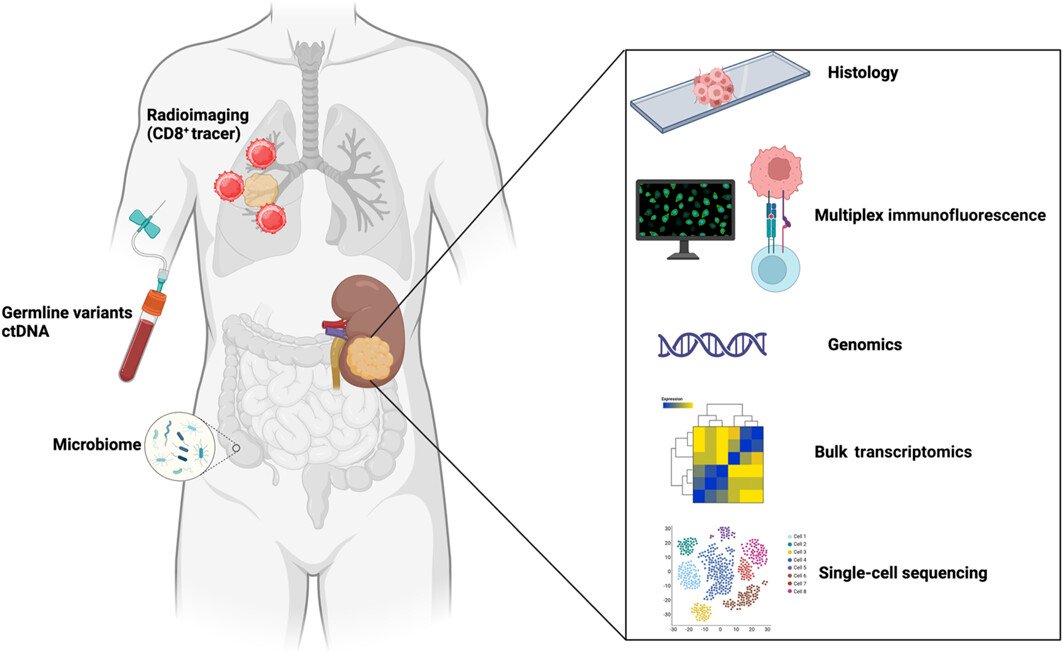 SUO 2024: Biomarkers and Clinical Predictors in RCC