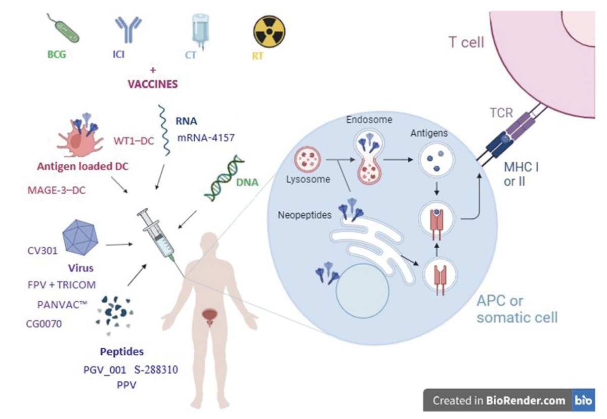 EAU 2025: Intravesical Drug Delivery: Devices Versus Vectors - What Is ...