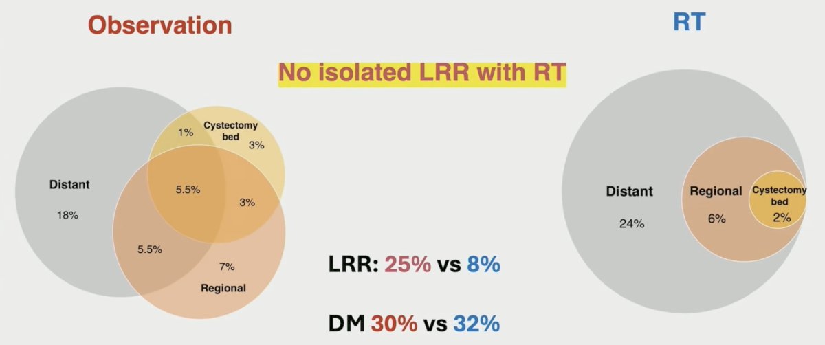 ASTRO 2025: Bladder Adjuvant Radiotherapy (BART): Clinical Outcomes ...