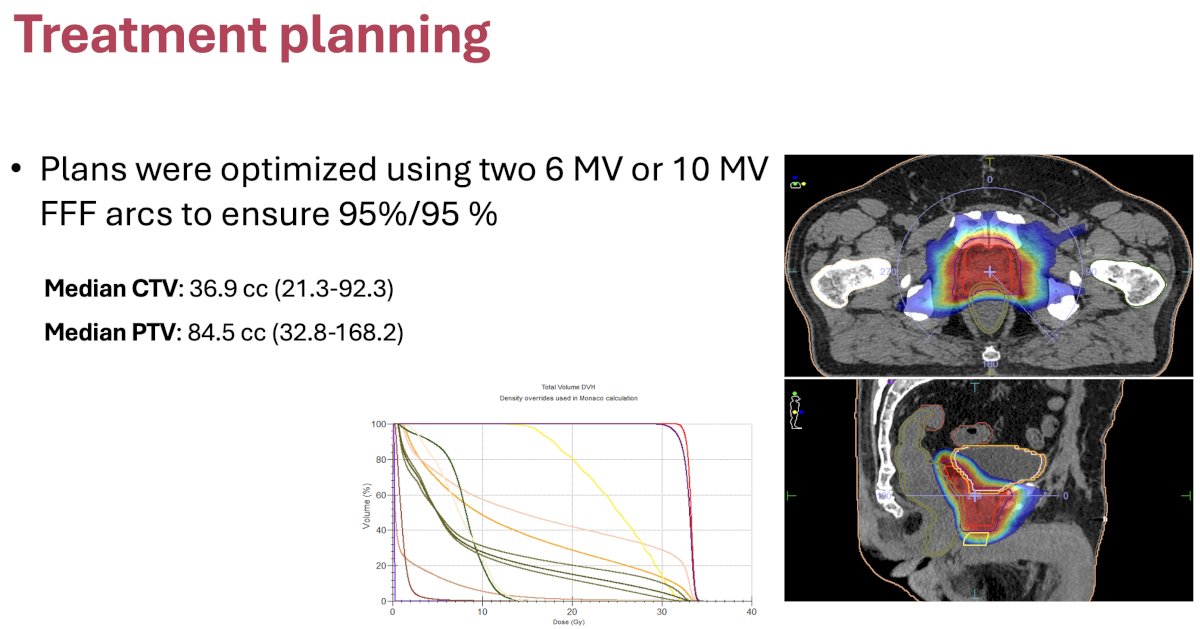 ASTRO 2025: Safety and Efficacy of POstoPerative Ablative RadioTherapy ...