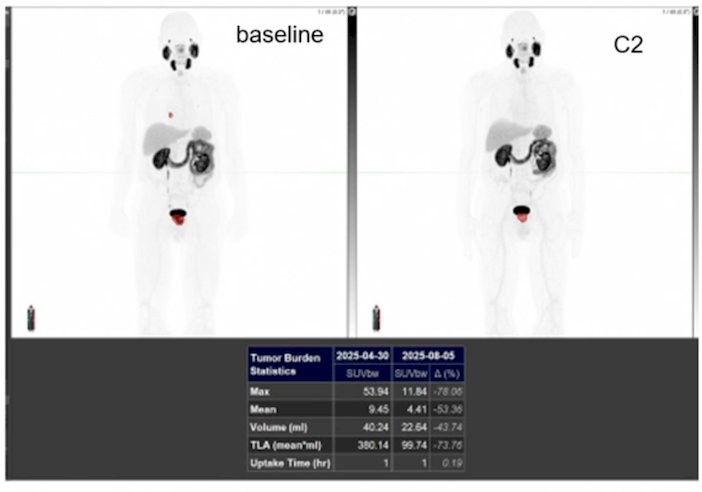 PSMA and Beyond 2026: Clinical Trial Updates: PEACE-6 PR Trial