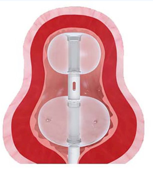 AUA 2026: State-of-the-Art Lecture: New Developments in Urinary Catheters