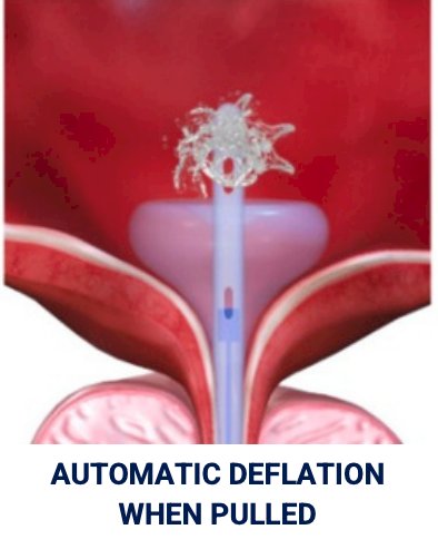 AUA 2026: State-of-the-Art Lecture: New Developments in Urinary Catheters