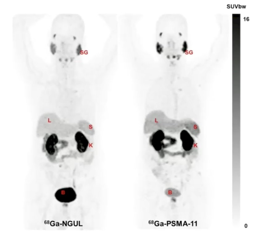 SNMMI 2026: Predictive Value of Baseline PSMA PET Imaging Biomarkers in ...