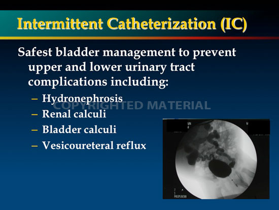 AUA 2012 - Intermittent and external urinary catheterization - Slide ...
