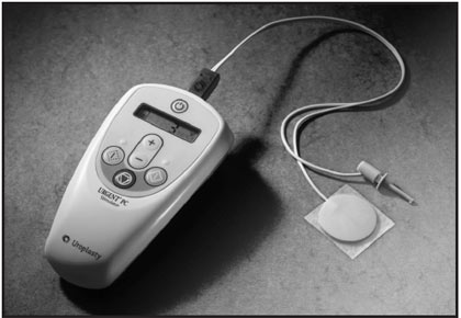 Incorporating percutaneous tibial nerve stimulation (PTNS) into a ...